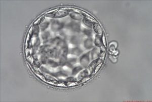 Blastocyst 5ΑΑ (Hatching blastocyst of excellent quality) | Assisting ...